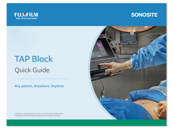 Get your TAP Block Quick Guide | Sonosite
